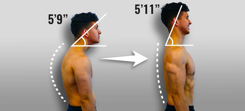 Height Increase treatment Ayurvedic by Monga Clinic Amritsar